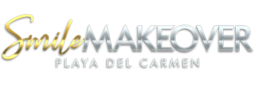Smile Makeover Mexico ⋆ Dental Makeover ⋆ Playa del Carmen Dentist